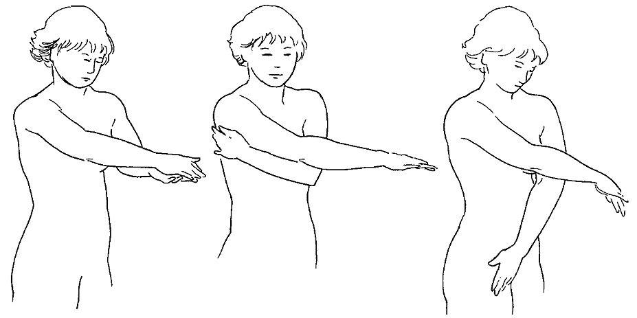 Lymfedrænage af højre arm