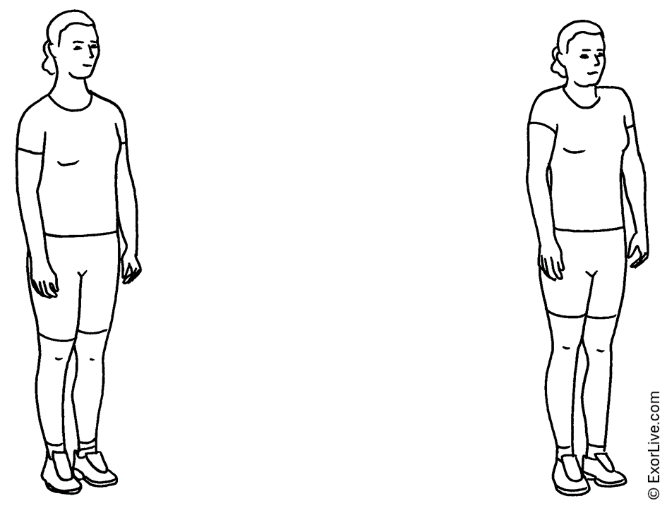 Albue - brækket med hele armen i gips