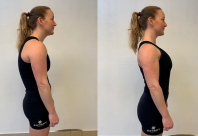 Løsnet skulderkapsel - genoptræning