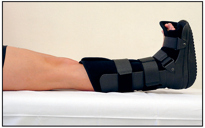 Underbenet/foden i gips eller bandage