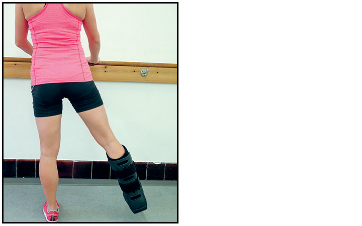 Underbenet/foden i gips eller bandage