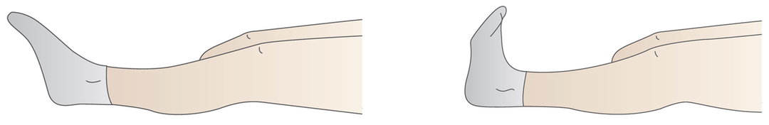 Amputation af ben (underbensamputeret) - øvelser