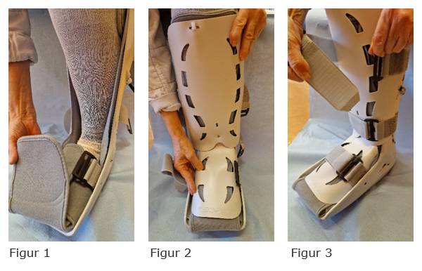 Patientinformation om Aircast XP Walker