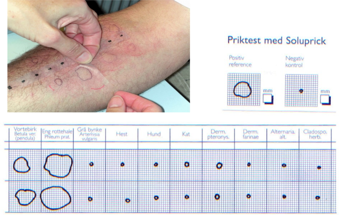Priktest