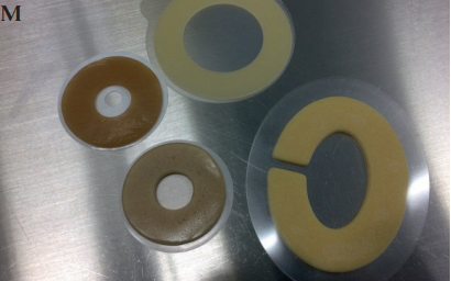 Oftest stillede spørgsmål om stomi