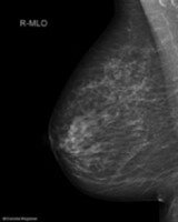 Røntgenstråler og strålebeskyttelse