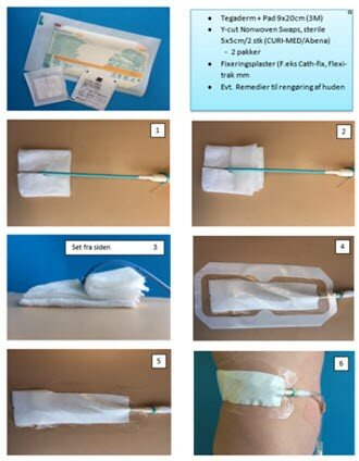 Anlæggelse af PTC-dræn