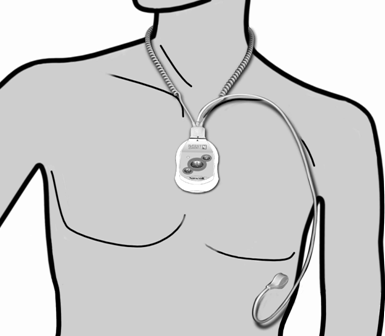 R-Test (Medicinske Sygdomme, klinik 1)