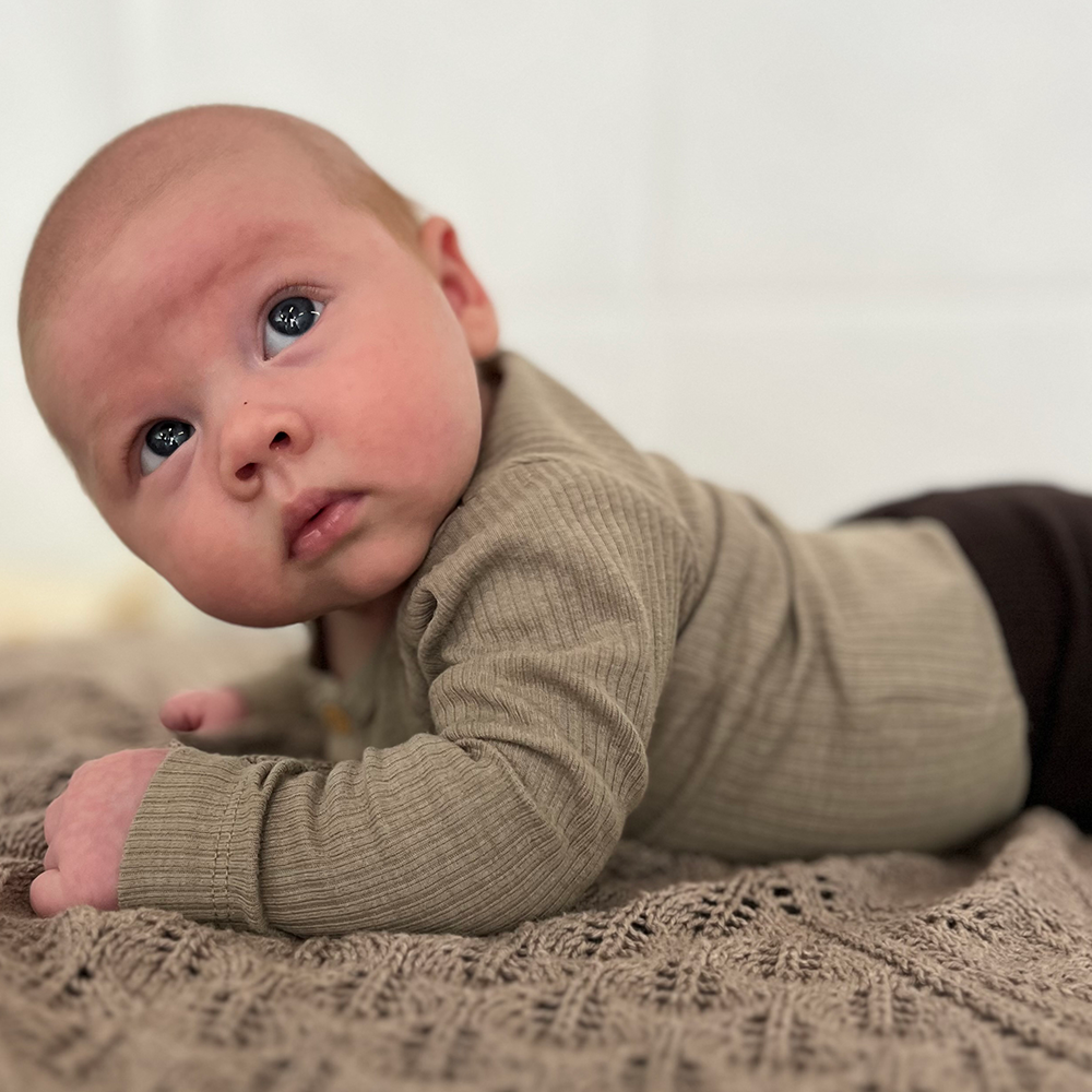 Behandling af skævt hoved, når barnet foretrækker at dreje hovedet til ...