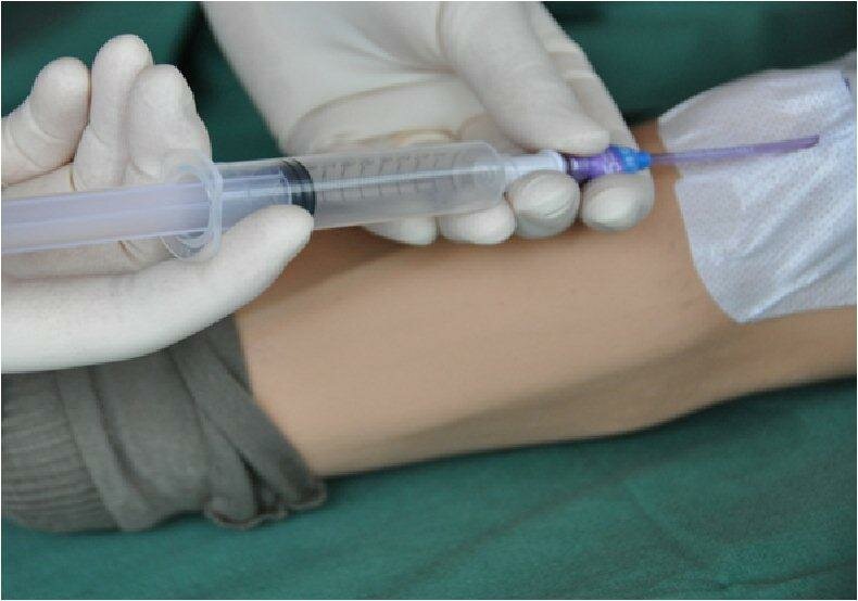 PICC-line-kateter, brug og pleje af et