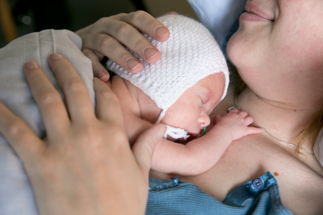 Early home discharge