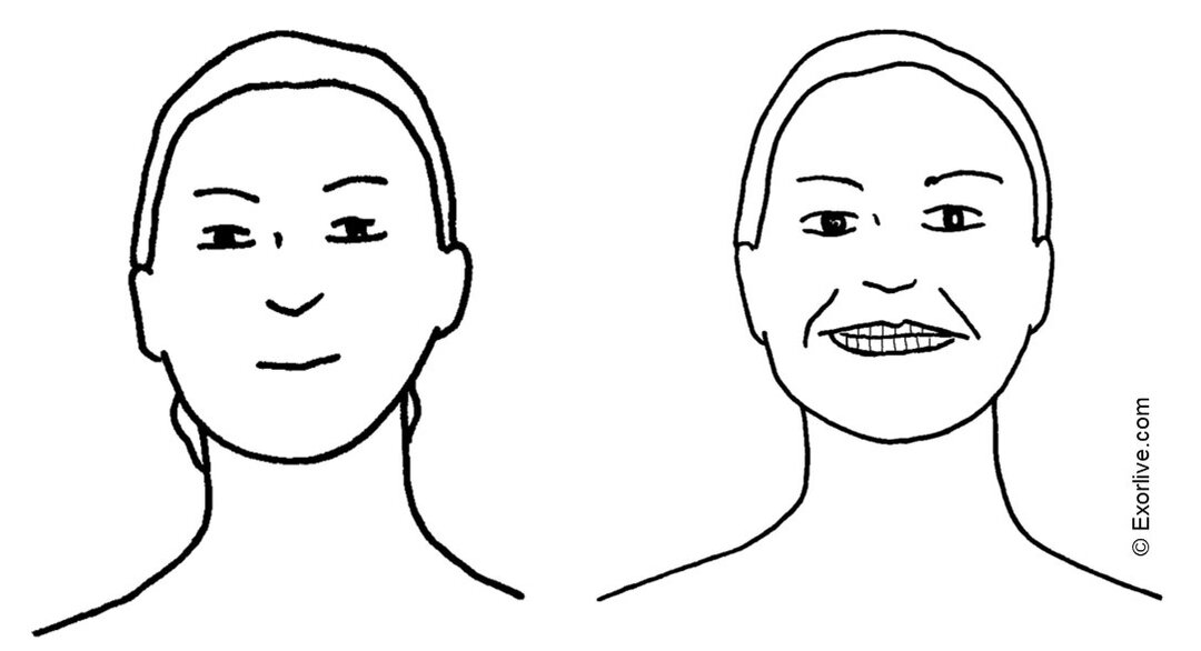 Mimikøvelser - hvis du har svært ved at bruge dine ansigtsmuskler