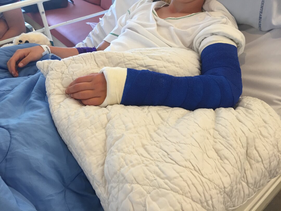 When your child has broken a bone