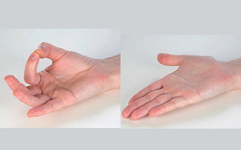 Hånd: Træningsprogram til patienter med brækket håndled