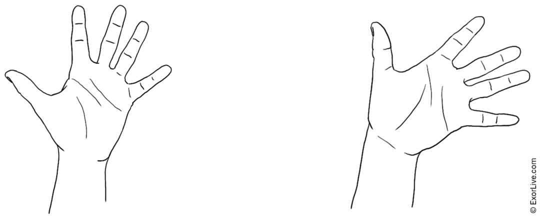 Håndleddet - kikkertoperation