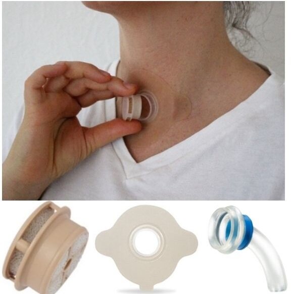 Struben - information om fjernelse af (laryngektomi)