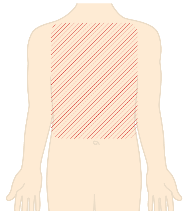 Fuglebryst - operation