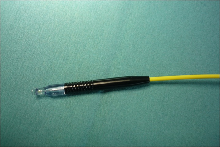 Grøn stær - behandling med cyclodiodelaser