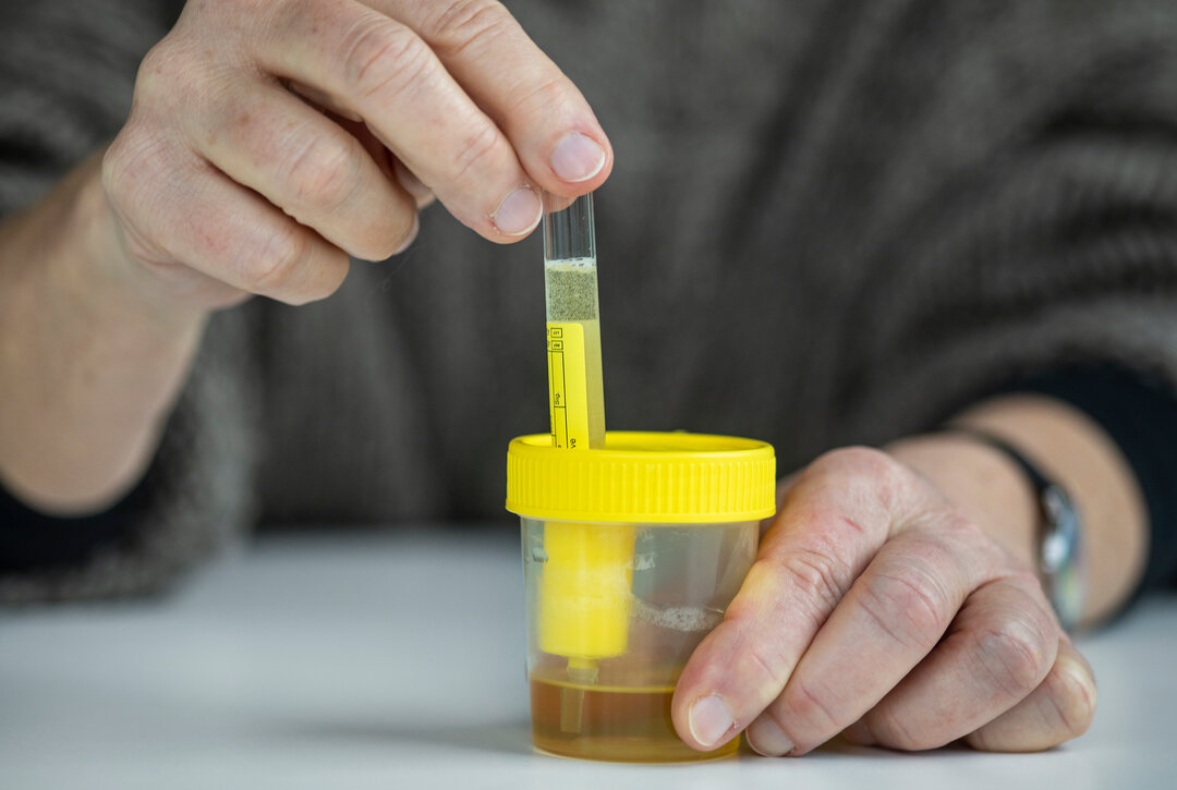 Collection of urine sample - Opsamling af urinprøve